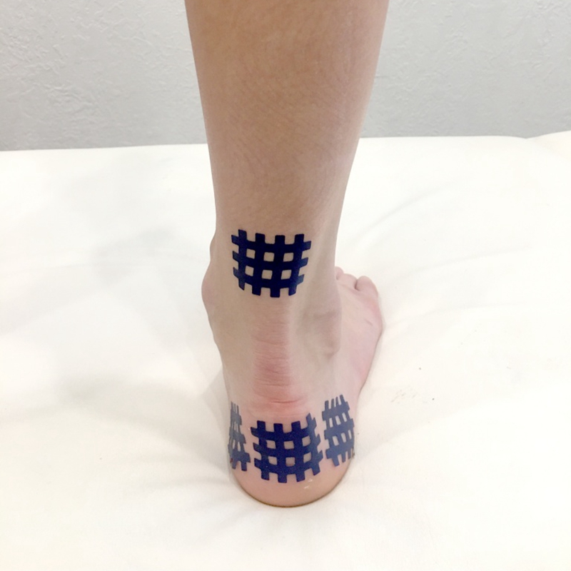 Acupuncture Tape | Cross Tape | Muscle Grid Tape