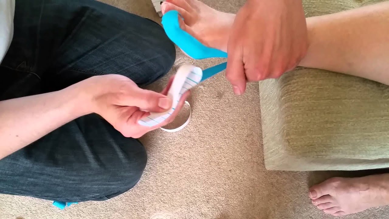 Does kinesiology tape for bunions really work-WEMADE TAPE